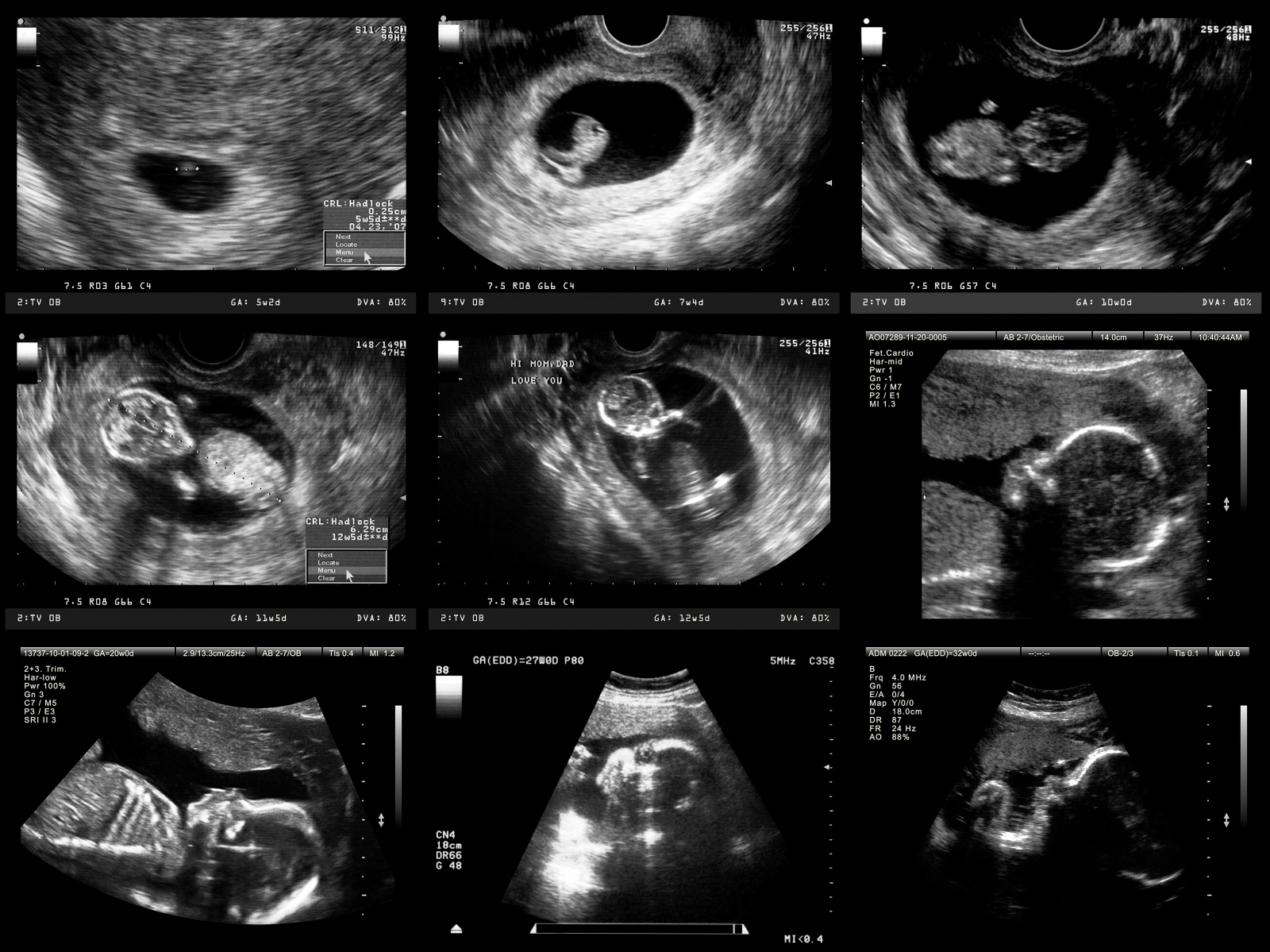 Alien Ultrasound Movie